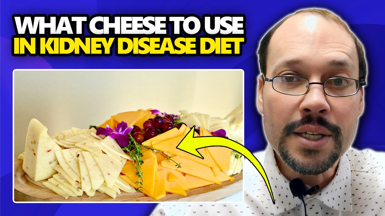 Cheese In A Kidney Disease Diet: What Cheese Maybe Ok On A Renal Diet. Should You Have Cheese w/ CKD