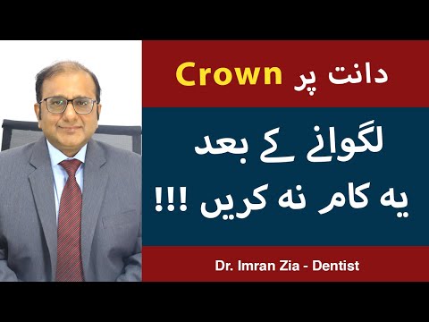 Dental Crown Procedure In Urdu/Hindi - Teeth Crowning - Must watch before dental work - Dr.Imran Zia