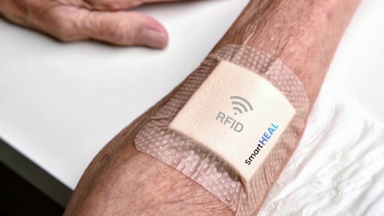 Smart plaster detects how wounds are healing
