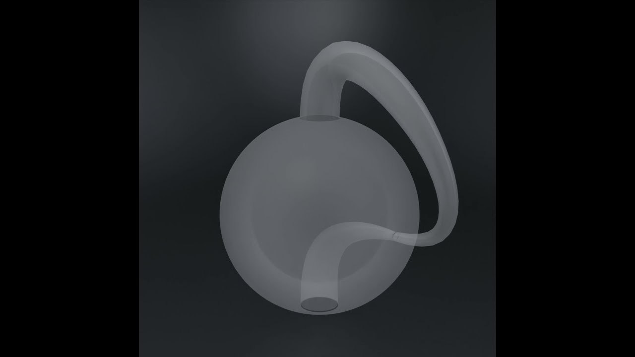 Klein bottle to S1 v S1 v S2