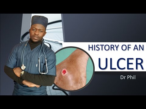 History of an ULCER