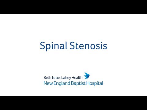 What is Spinal Stenosis? Anatomy, Causes and Epidemiology