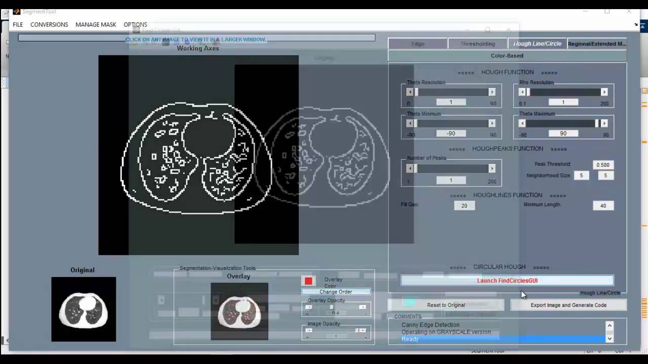 Digital image processing using matlab projects