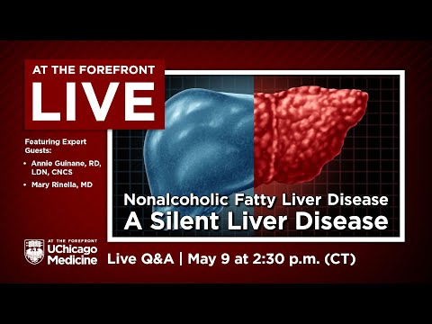 Nonalcoholic Fatty Liver Disease - A Silent Liver Disease - Expert Q&A