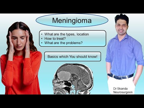 Meningioma: Symptoms, Treatment. Most common benign brain tumor. Things U should know. By Dr Skanda