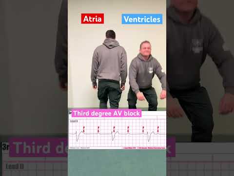 8 ECG rhythms through the medium of dance