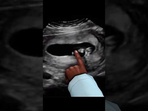 ultrasound day#sims4 #fypシ゚viral