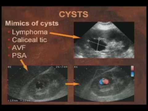 Practical Reviews in Ultrasound Kidneys & Adrenals