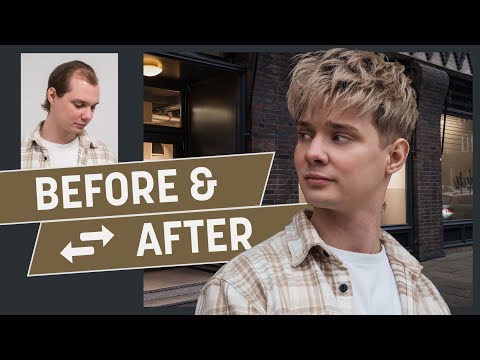 On-trend hairstyle transformation for men 2021 – from half-bald to rock star look (before & after)