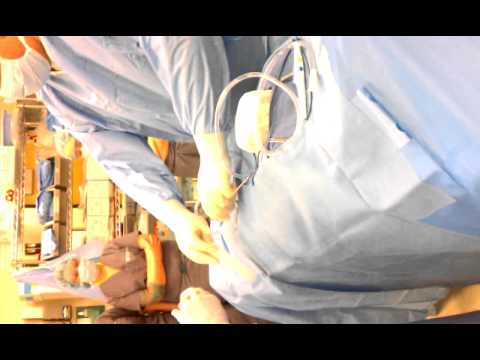 Breast biopsy cc