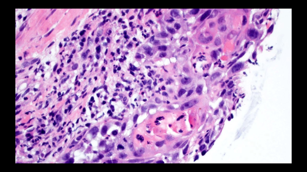 Cases with Dr Keeney: Case #4