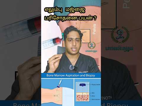 எலும்பு மஜ்ஜை பரிசோதனை என்றால் என்ன|Bone marrow aspiration|Bone marrow biopsy #bonemarrowaspiration