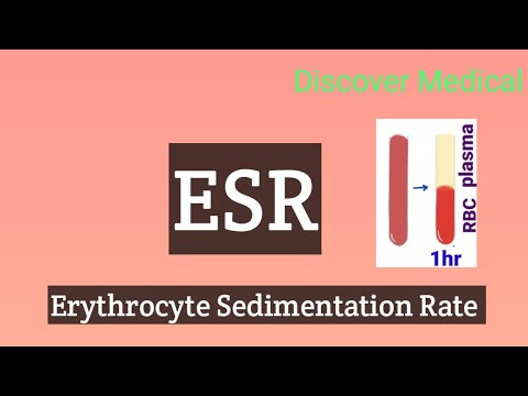 ESR test | Sed rate test...