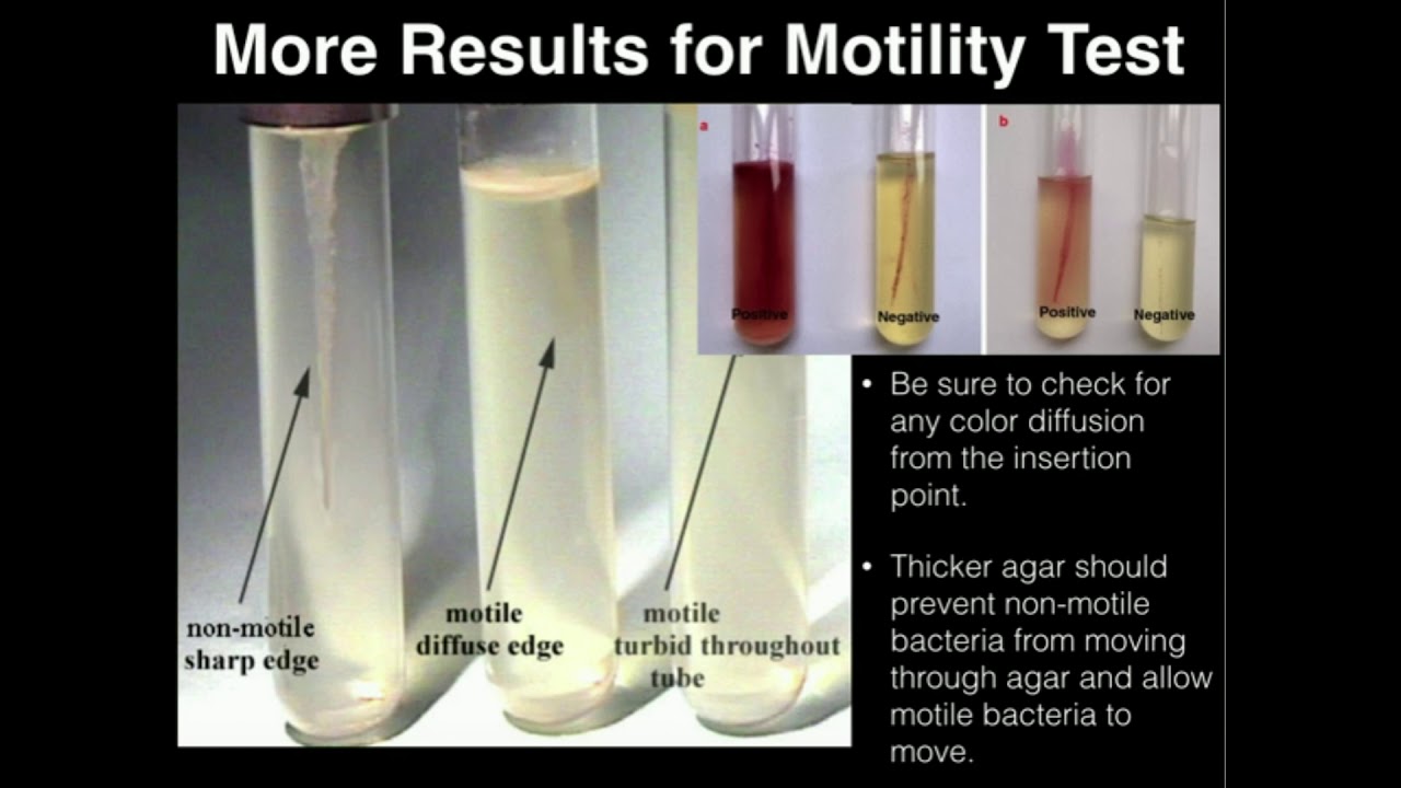 Microbiology: Motility Test