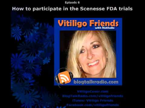Treatments & Trials for Vitiligo: How to Participate in the Scenesse FDA Trials