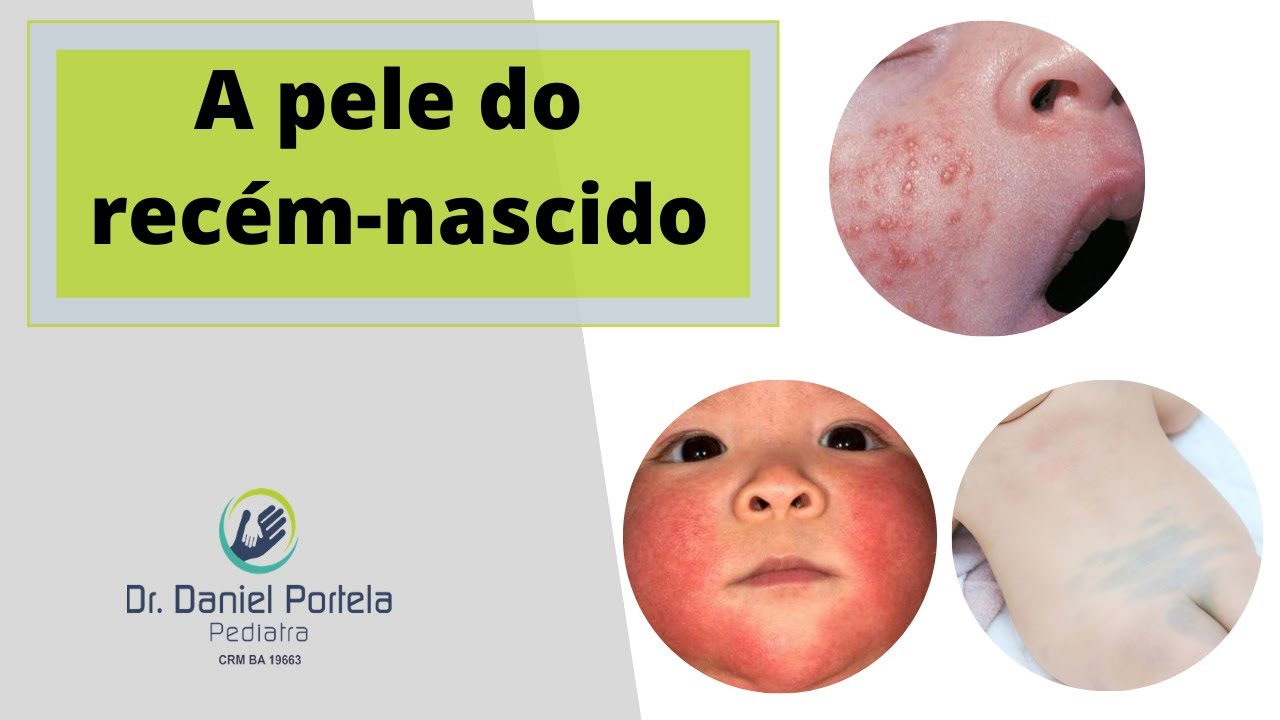 A pele do recém-nascido