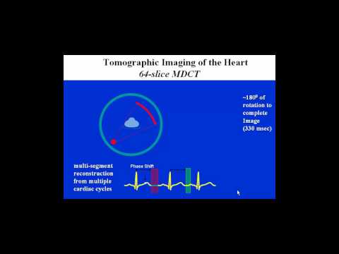 CCTA Training Lecture 1B Temporal and Spatial Resolution in Cardiac CT