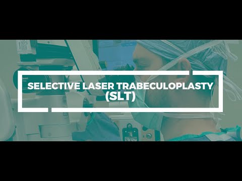 Selective Laser Trabeculoplasty (SLT)