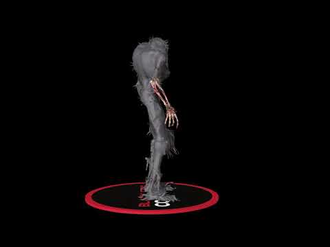Hulking Summoner Turntable Comparison (CWZ)