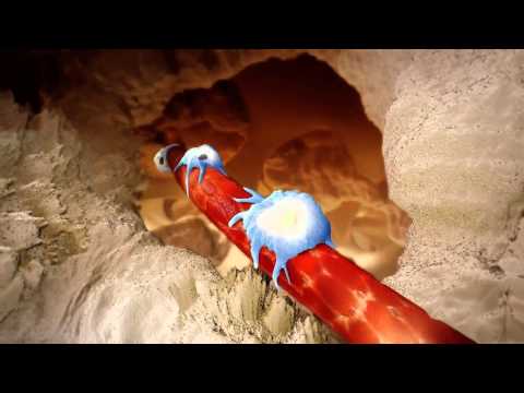 Bone Remodeling