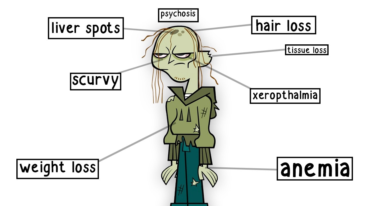 What Happened to Ezekiel? | Total Drama Theory