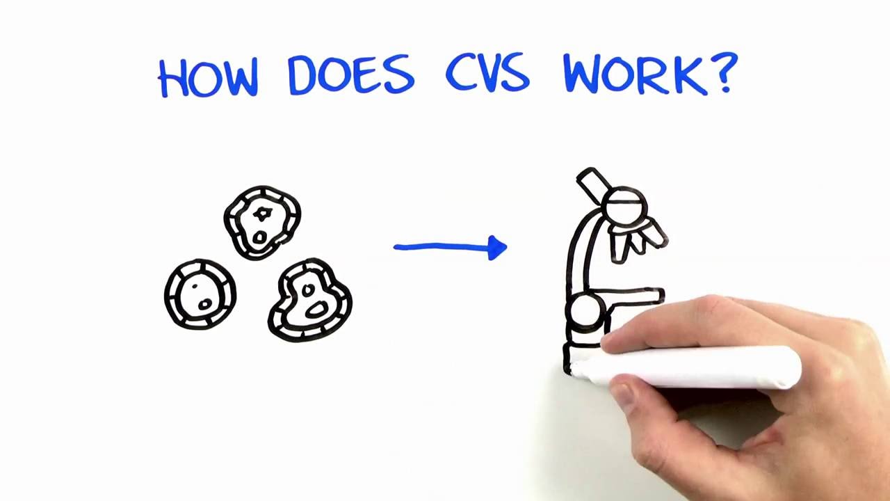Chorionic Villus Sampling (CVS)