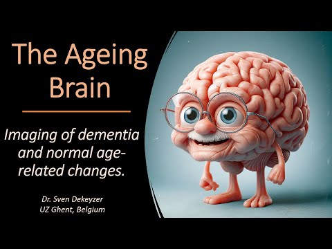 Imaging of dementia and brain ageing.