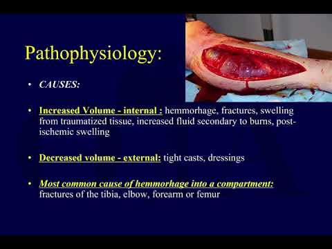 Compartment syndrome 1 - pathophysiology (OTA lecture series III g04a)