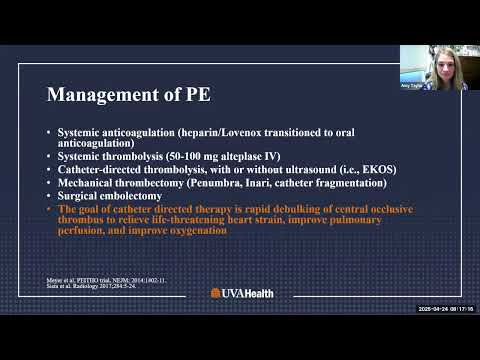 Road2IR: Pulmonary Embolism Management