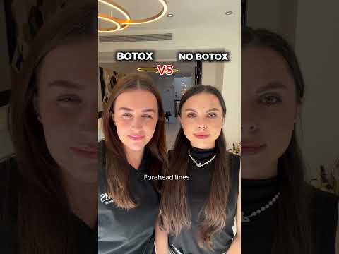 BOTOX VS NO BOTOX #antiaging #botulinumtoxin