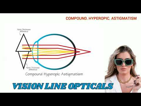 COMPOUND HYPEROPIC ASTIGMATISM EXAMPLE.