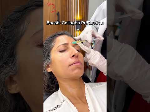 PRP Therapy for Face