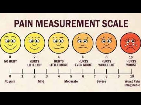 Pain | pain perception and physiology of Pain | Faces rating scale.
