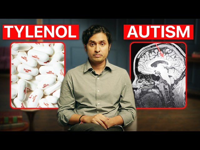 Exploring the Complex Relationship Between Acetaminophen and Autism ...