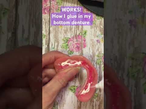 ❗️Bottom denture stays in all day❗️