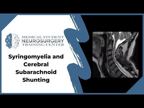 Syringomyelia and Cerebral Subarachnoid Shunting
