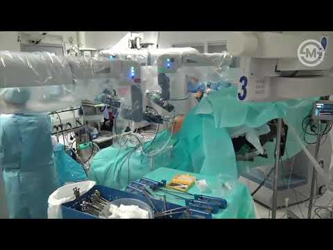 Here's What the New Robotic Surgery System Looks Like?