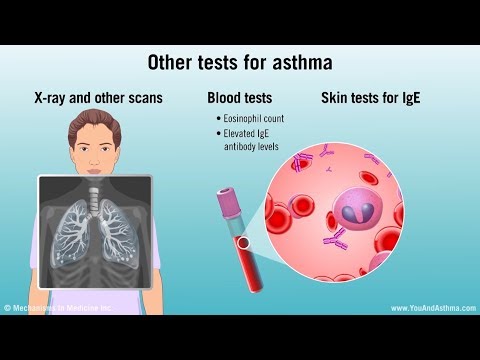 The Best Tools and Treatments for Severe Asthma