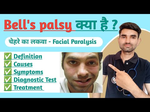 Bell's palsy in Hindi | Causes, Symptoms And Treatment of Bell's palsy | Facial Paralysis in Hindi