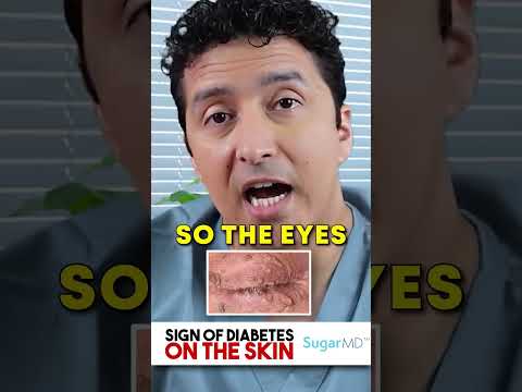 This is a SIGN OF DIABETES on the skin! BE AWARE!