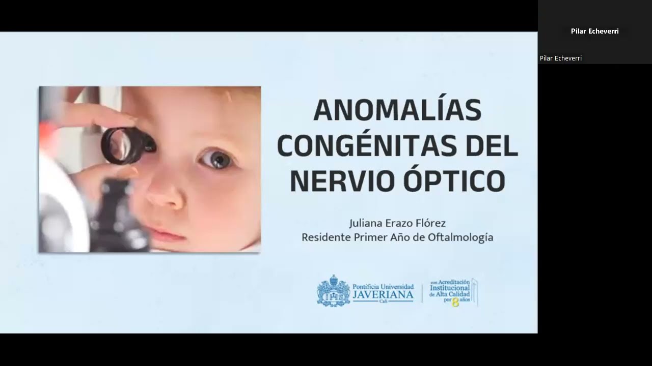 Congenital anomalies of the optic nerve - Dr. Juliana Erazo F (Pediatric Ophthalmology)