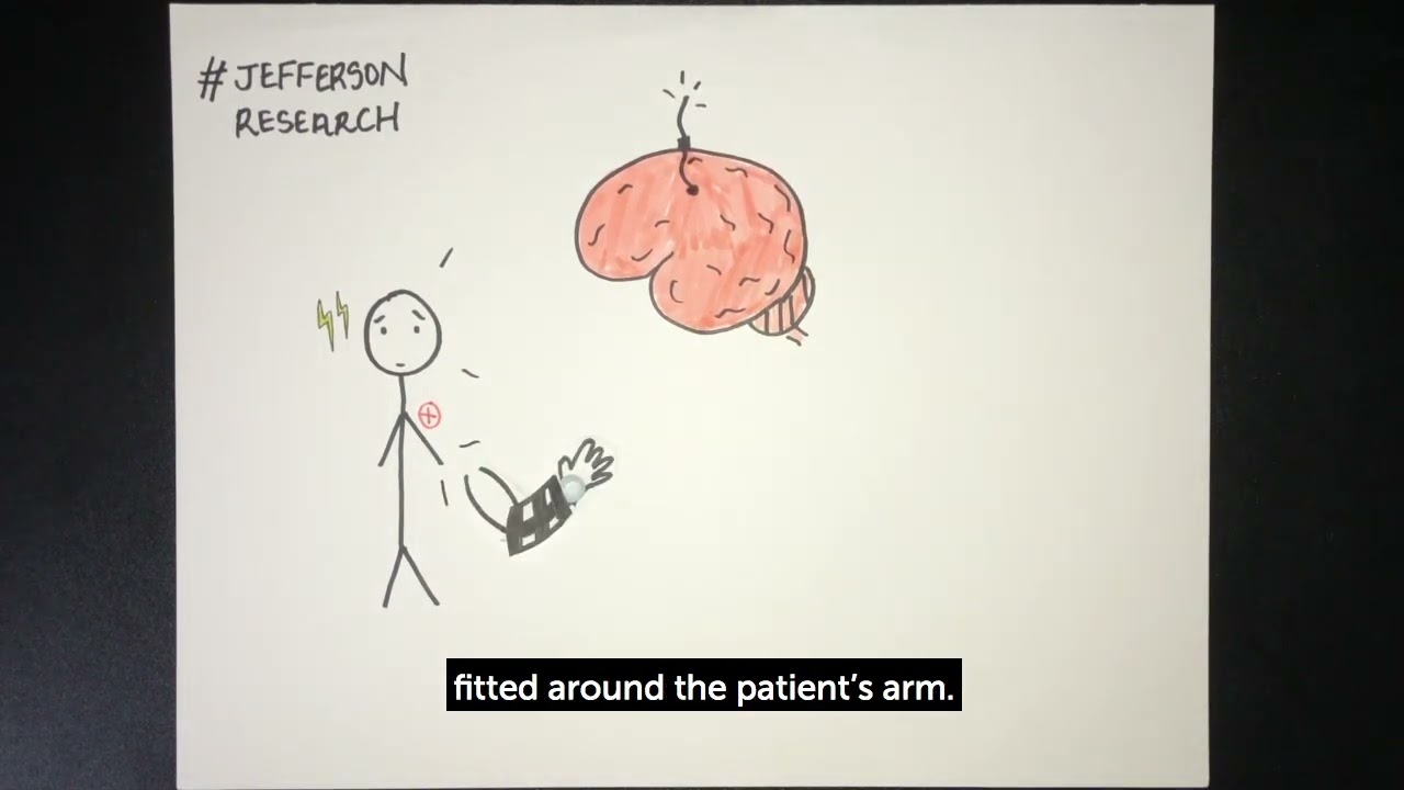 Using brain-computer interface to restore arm movement after a stroke
