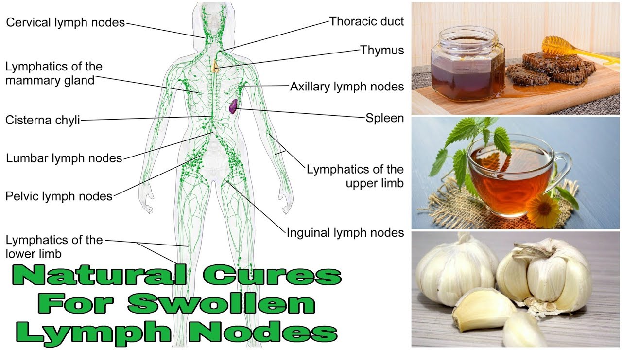 Natural Cures For Swollen Lymph Nodes