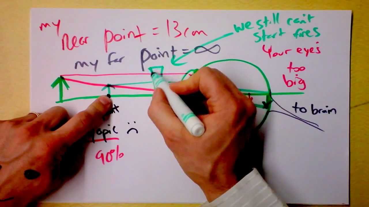 Optometry 101 | Corrective Optics for Myopic and Hyperopic Vision | Doc Physics