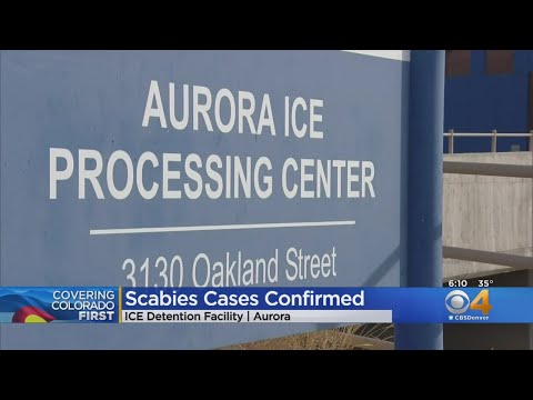 Officials Trying To Contain Scabies Infestation At ICE Facility