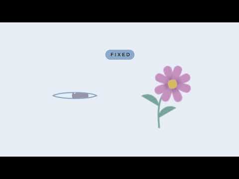LAL (Light Adjustable Lens) Video