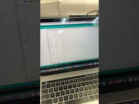 EMG Test | Electromyography Testing and Conduction Study | #BME320