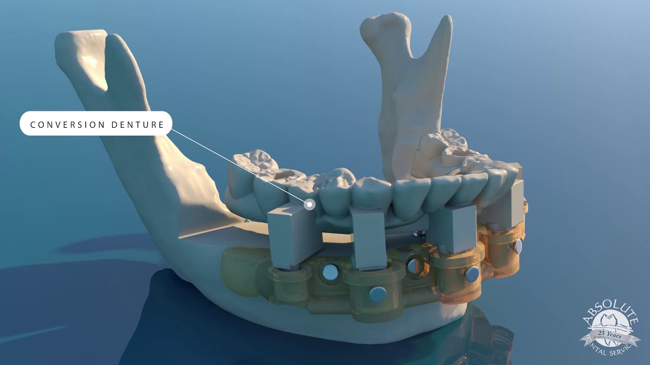 Introducing Navagation Precision Guidance