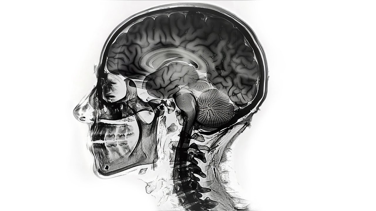 Understanding Brain Rot: The Impact of Digital Overstimulation | Galaxy.ai