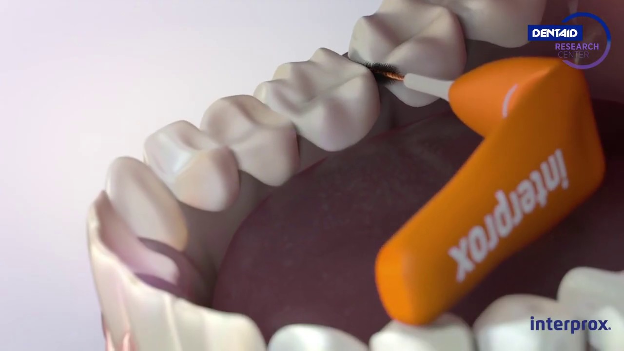 The interproximal cleaning revolution has arrived: New Interprox®